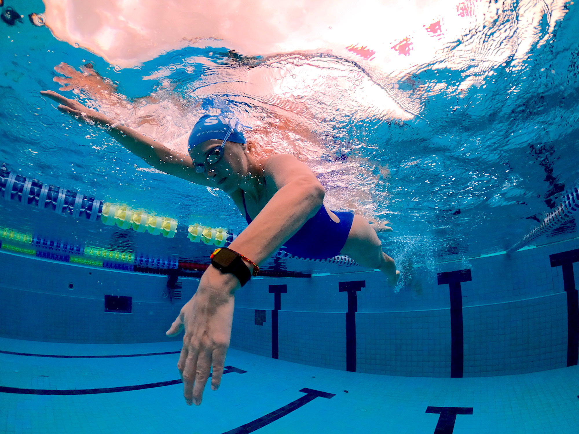 What is Early Vertical Forearm? (EVF)